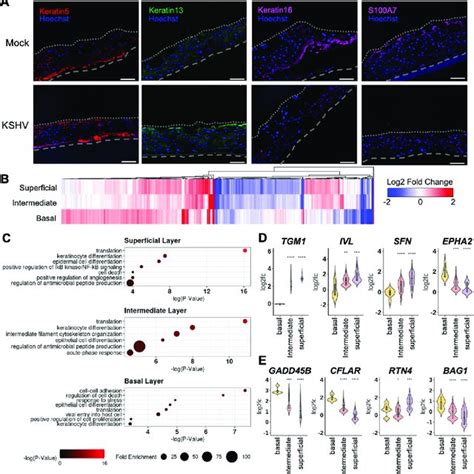 Kshv Infection Dysregulates Host Epithelial Differentiation A
