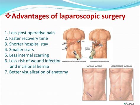 Laparotomy Procedure Step By Step At Lisa Bassett Blog
