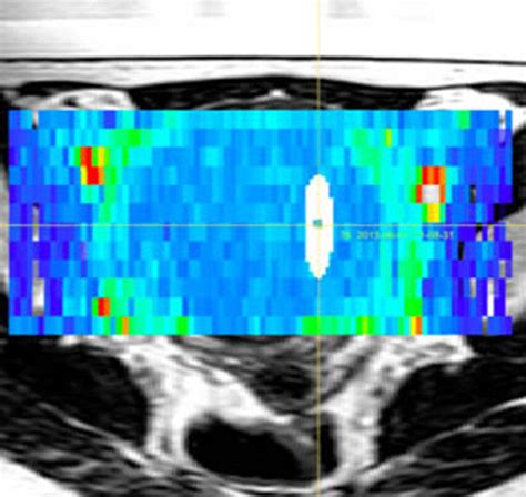 Visualization And Regional Image Analysis For Multi Parametric Download Scientific Diagram