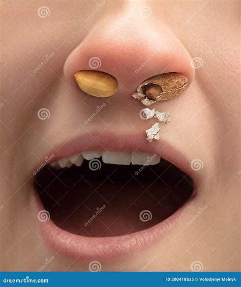 Close Up Human Nose With Allergen Causes A Runny Nose And Sneezing