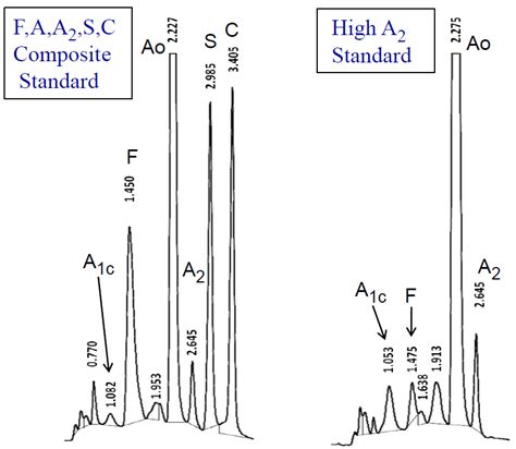 Analysis Of Hemoglobin Variants Quantitation Of Hba1c
