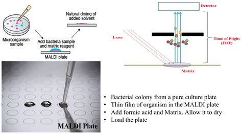 Medical Microbiology Lab Series 10 Maldi Tof In Microbial Diagnostics