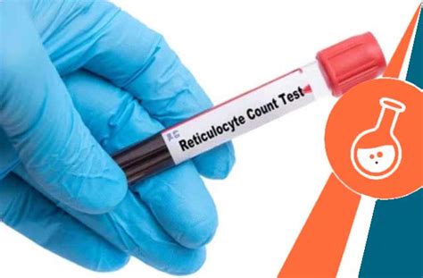 Reticulocyte Count Reticulocytosis Book Retic Count Rs 300