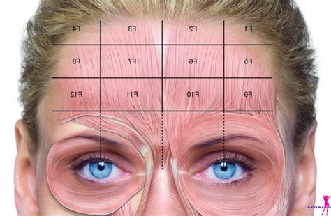 Botox Frontalis How Is It Performed