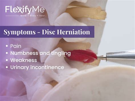 Disc Herniation What Is It Causes Symptoms And Treatment