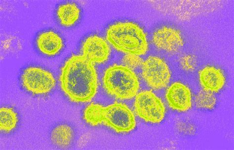 Bayesian Viral Allele Selection For Sars Cov 2 Genomic Surveillance