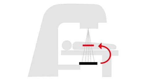Reimagining Patient Qa 3d Epid Dosimetry Leverages Monte Carlo Calculations Physics World
