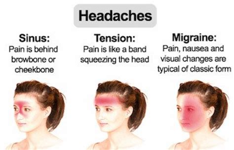 Headache Locations And What They Mean
