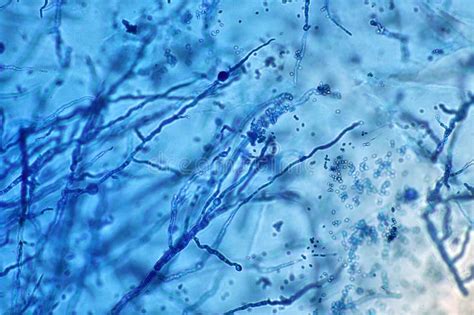 Microscope Of Black Fungus Spore Strain With Lactophenol Cotton Blue