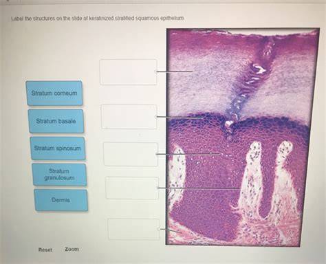 Solved Label The Structures On The Slide Of Keratinized