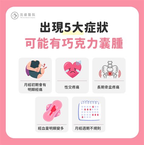 「巧克力囊腫」是什麼？形成原因、症狀與高危險群解析 Tnl The News Lens 關鍵評論網