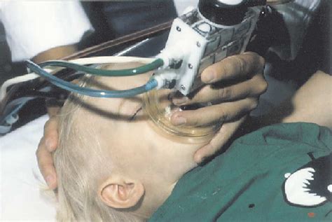 Figure 2 From Analysis Of Tidal Breathing Flow Volume Loops For Automated Lung Function