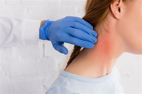 „Пълмед“ с кампания от безплатни прегледи за кожни алергии