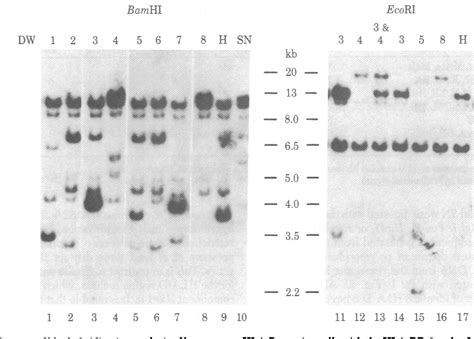 Figure 1 From Detection Of Hla Ddr Related Dna Polymorphism In Hla D Figure 1 From Detection Of Hla Ddr Related Dna Polymorphism In Hla D