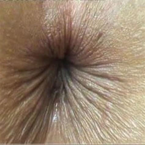 Close Up Butthole Winking Free Butthole Tube Porn Video D Xhamster
