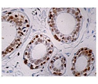 RUNX1 Antibody A 2 Immunohistochemistry Image 161085