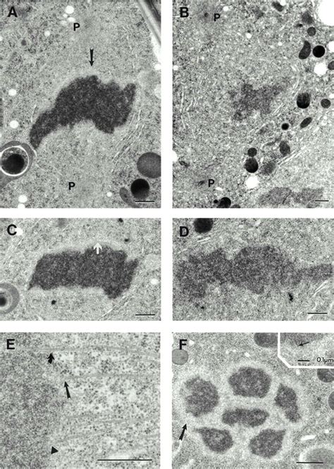 Depletion Of Him 10 Disrupts The Morphology Of The Mitotic Kinetochore Download Scientific