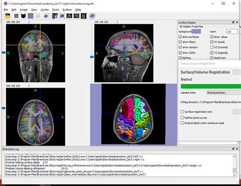 tutorials segbrainsuite brainstorm
