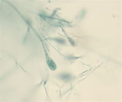 Microsporum Nanum The Macroconidia Enlarged Terminal Stru… Flickr