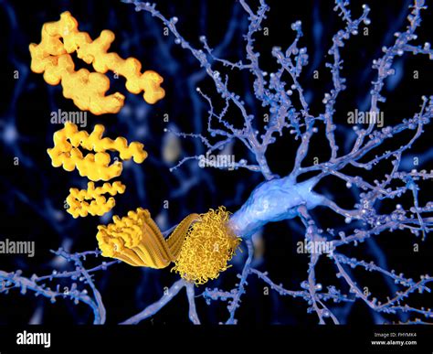 Amyloid Beta Peptide Computer Illustration This Protein Is The Primary Component Of Amyloid