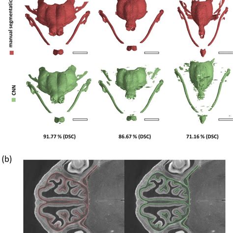 Visualisation Of The Proposed Segmentation Models Output Together With Download Scientific