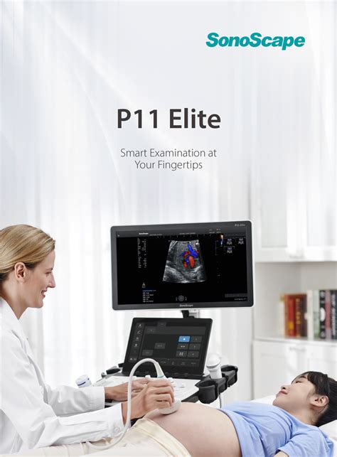 Sonoscape P11 Elite Trolley 3d4d Color Doppler Ultrasound Machine