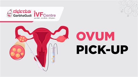 What Is Ovum Pickup Heres What You Need To Know