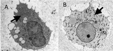 Dark A And Light B Chondrocytes With The Transmission Electron Download Scientific Diagram