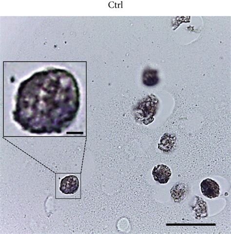 Immunohistochemical Staining For Total Type Ii Collagen In