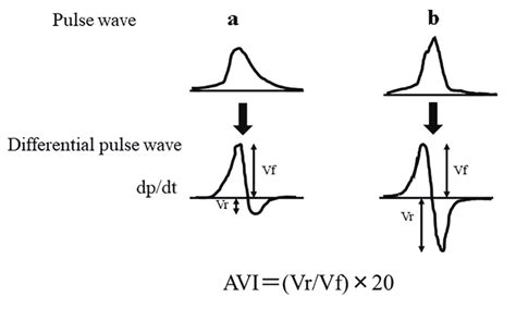 The Measurement Concept Of The Avi Avi Has The Characteristics Of A