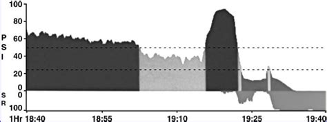 SEDline Tracing Of Patient Number 7 Download Scientific Diagram