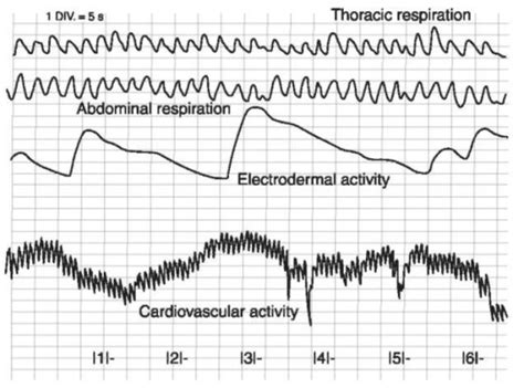 Facts You Must Know About Lie Detector Test Polygraph Test