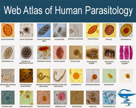 Do You Have Parasites Brenda Eastwoods Total Health Resource And Store