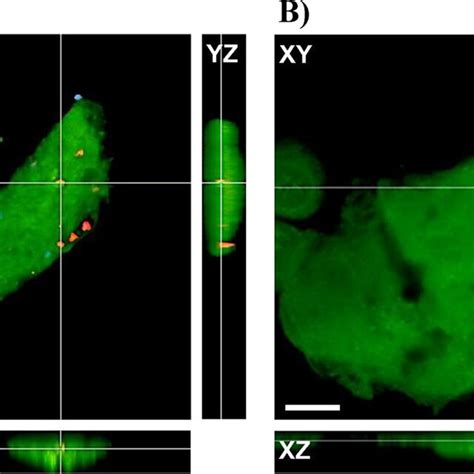 Intracellular S Aureus In Human Nasal Epithelial Cells Recovered From Download Scientific