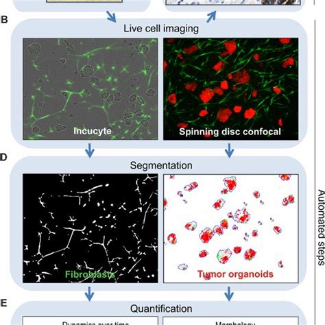 Tracking Of Tumor Stroma Morphology And Dynamics In Microtissues By