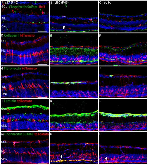 Repopulated Retinal Microglia Promote Müller Glia Reprogramming And Preserve Visual Function In