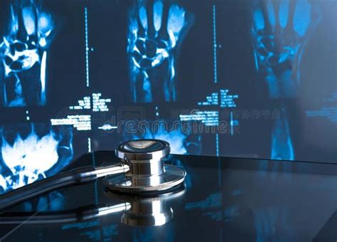 背景高清图片 基于x射线图像的数字平板电脑听诊器 基于x射线图像的数字平板电脑听诊器图片免费下载 5103612442 千图网pro