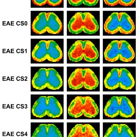 Registration Of Dti Parameter Maps Download Scientific Diagram