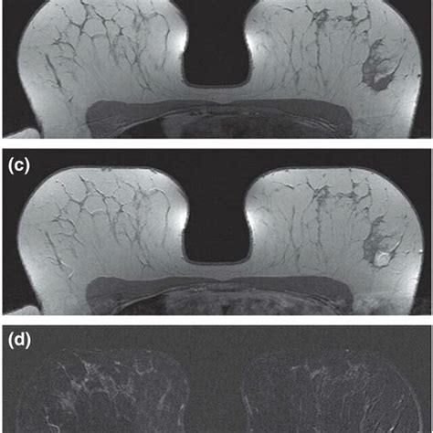 A Schematic Presentation Of Full Diagnostic And Abbreviated Protocols Download Scientific
