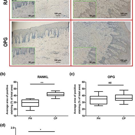 Receptor Activator For Nuclear Factor‐κb Ligand Rankl And