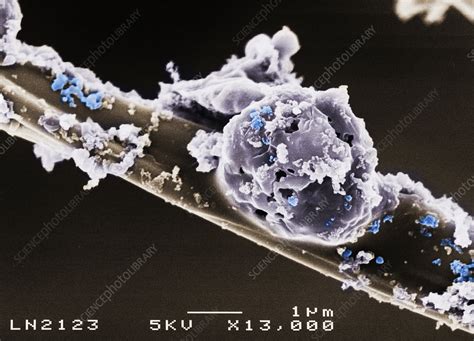 Dust Particles Sem Stock Image C0489804 Science Photo Library