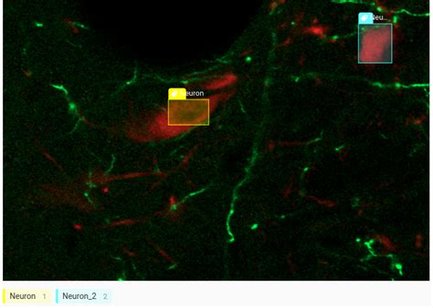 Biological Neuron Counting Using Ai Cogniflow Blog