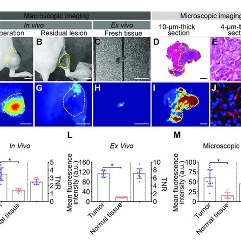 Quantitative Analysis Of Fluorescence Images From Fluorescence Guided
