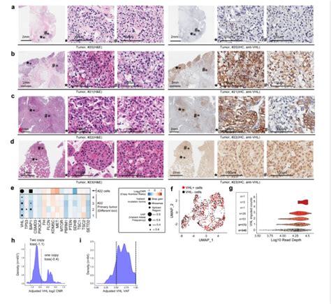 Nature子刊最新四川大学华西医院 加州大学研究团队发现可抑制癌症转移的新策略 转译 转化医学网 转化医学核心门户