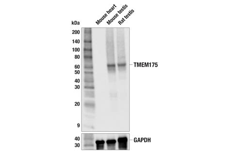 TMEM175 F5G5U Rabbit MAb Cell Signaling Technology
