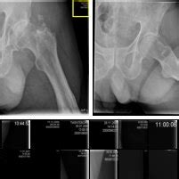 An Inspection Of PIP Net S Prototypes Can Reveal Data Quality Issues Download Scientific Diagram