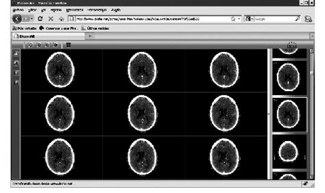 Typical Full Screen Visualization Of A Multi Frame DICOM File Download Scientific Diagram