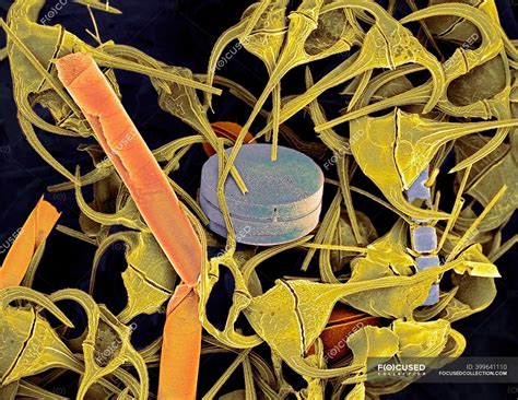 Plankton Coloured Scanning Electron Micrograph Sem Of Plankton