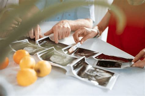 Transforming A Health Center Real Time Documentation Support