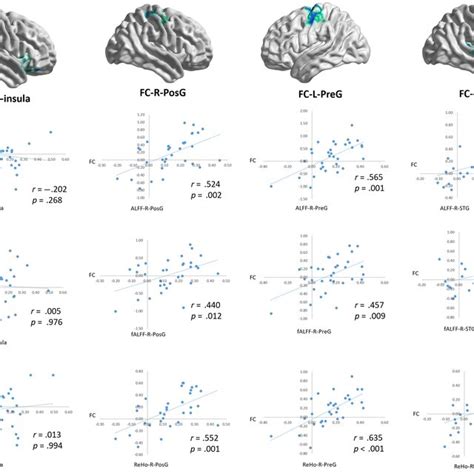 Brain Regional Activity After Itbs And Ctbs On Right Precuneus Alff Download Scientific